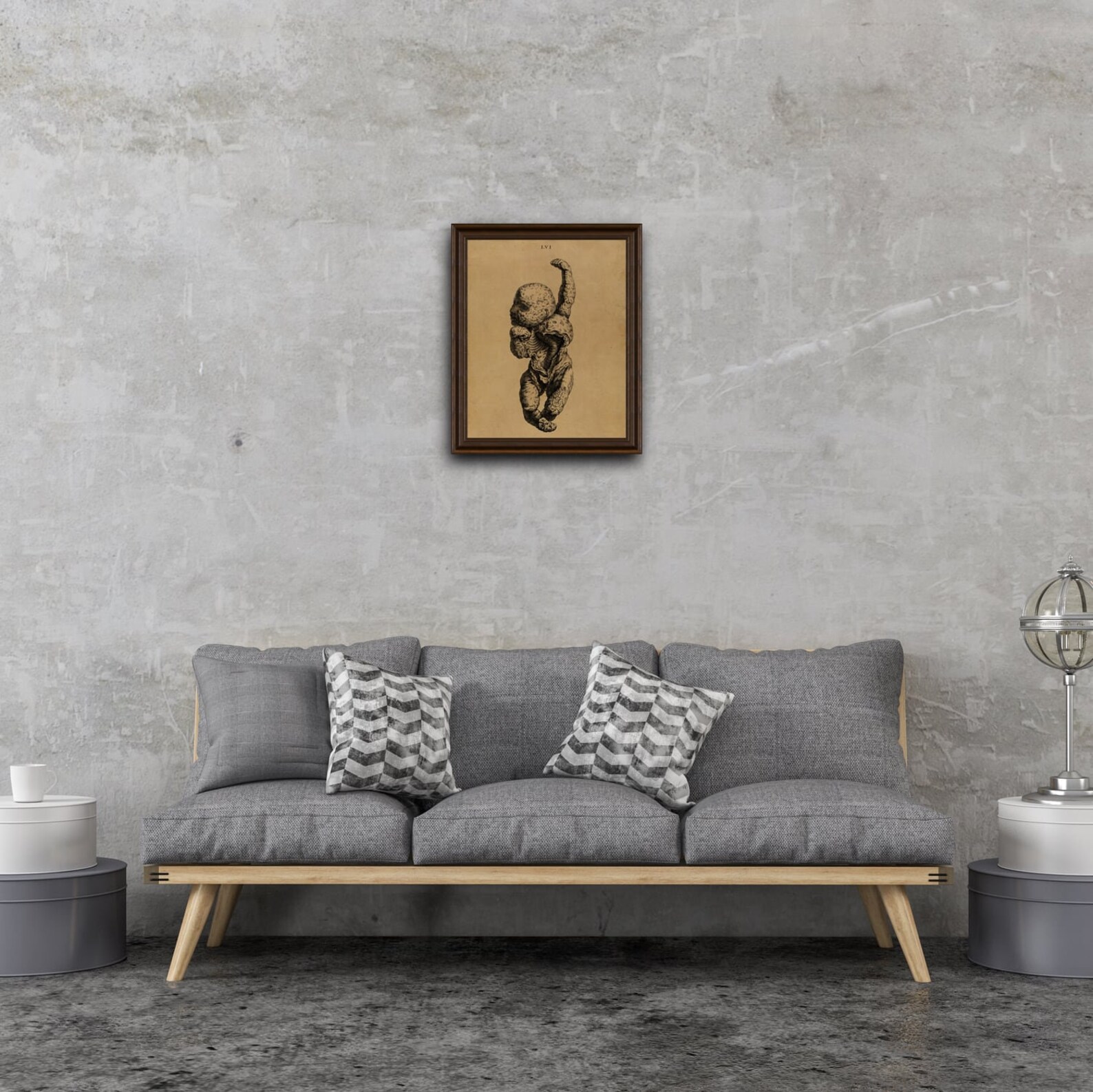 Anomaly Fetus Skeleton Stone Baby Anatomy Pathology - Etsy