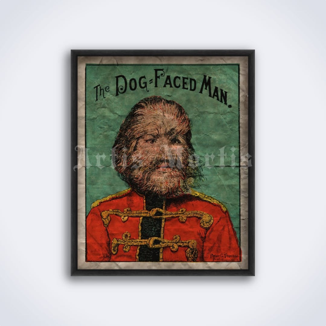 Dog Faced Man Fedor Jeftichew – Vintage 1880 Freak Show Poster, Human ...