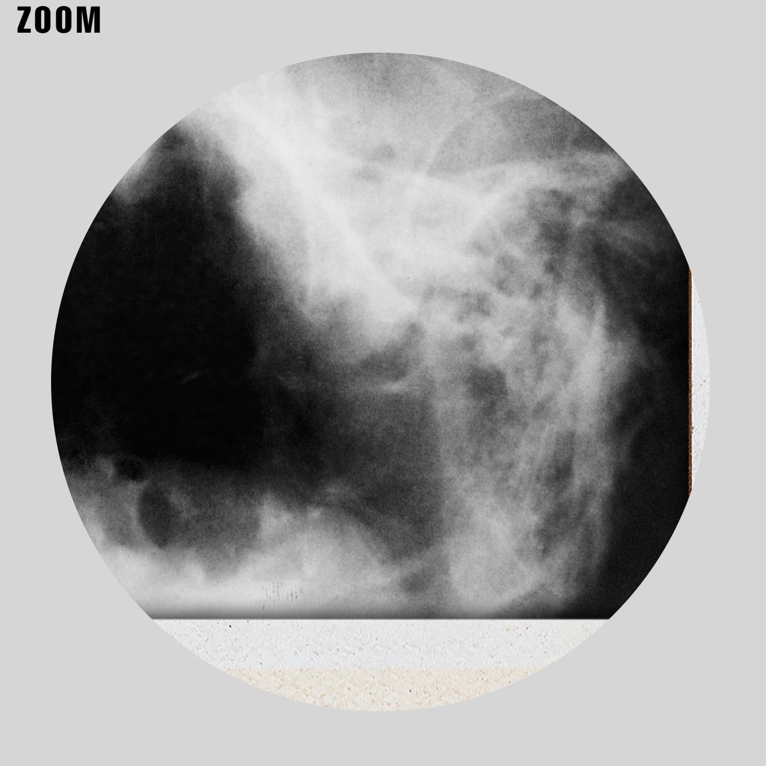 X-ray Human Skull Face Anatomy Radiology Photo Vintage - Etsy