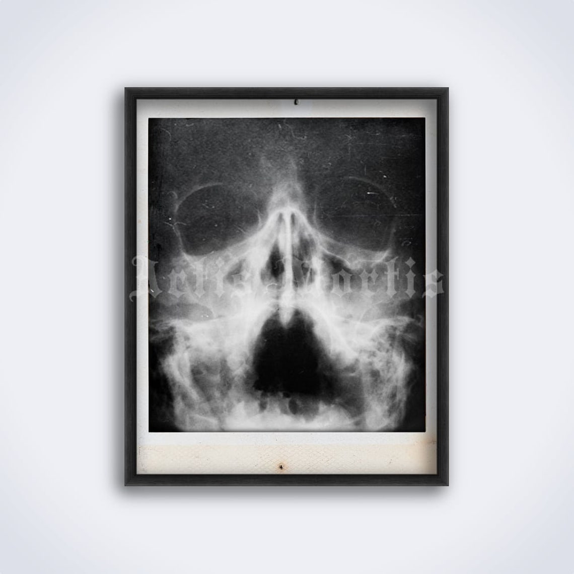 X-ray Human Skull Face Anatomy Radiology Photo Vintage - Etsy