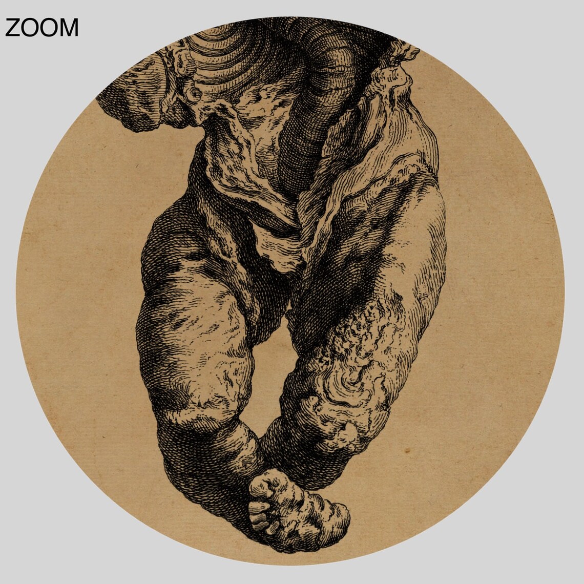 Anomaly Fetus Skeleton Stone Baby Anatomy Pathology - Etsy