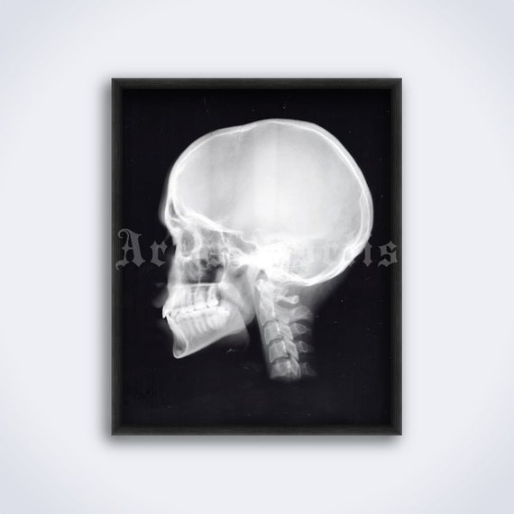 Lateral Skull X Ray Anatomy Film X Ray Skull Image & Photo (Free