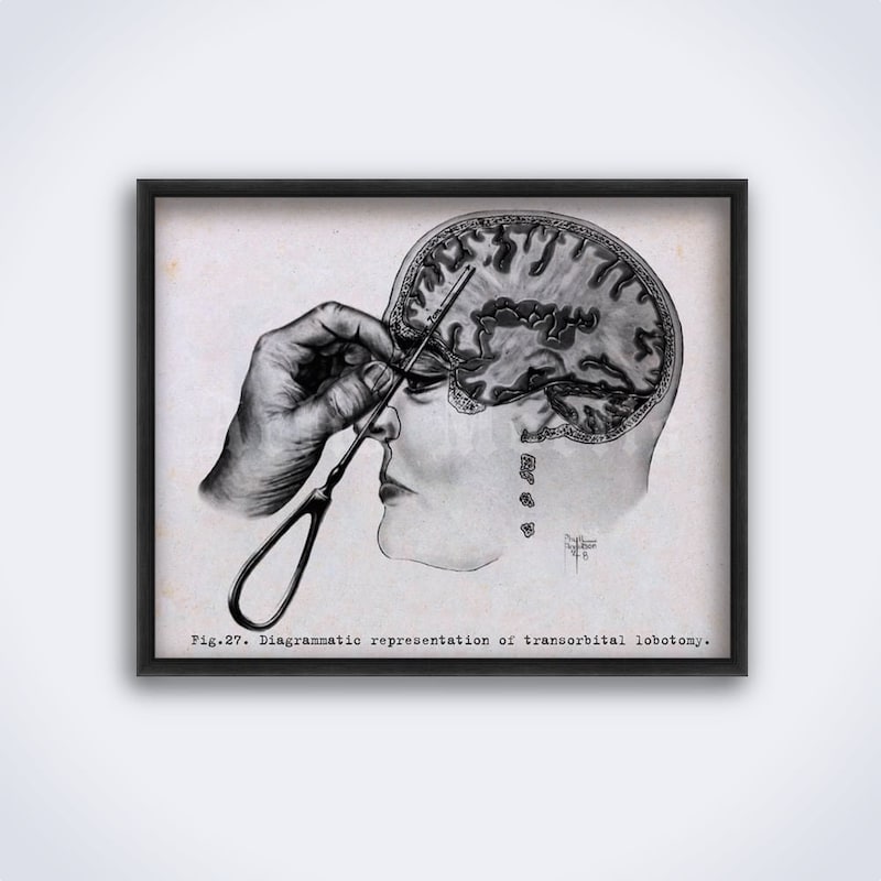 Lobotomy Kit - Etsy