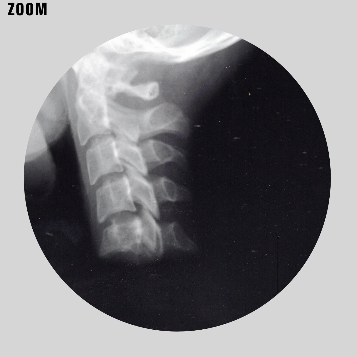 X-ray Human Skull Lateral View Anatomy Radiology Photo | Etsy