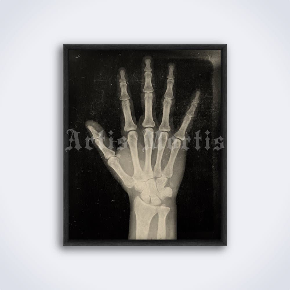 X-ray Human Hand Anatomy Radiology Photo Vintage Medical - Etsy