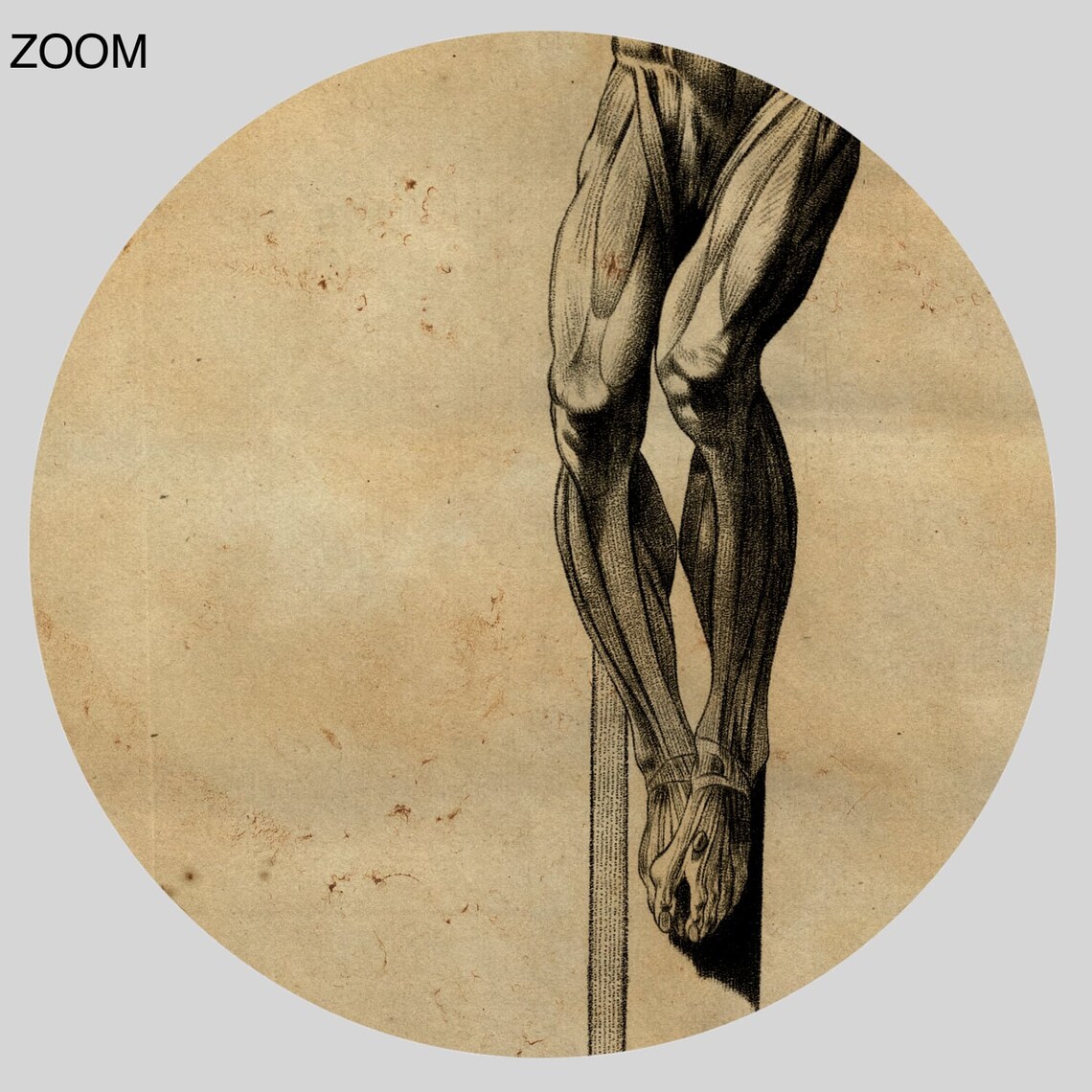 Crucified Human Body, Creepy Scary Corpse – Vintage Medical Art Print ...
