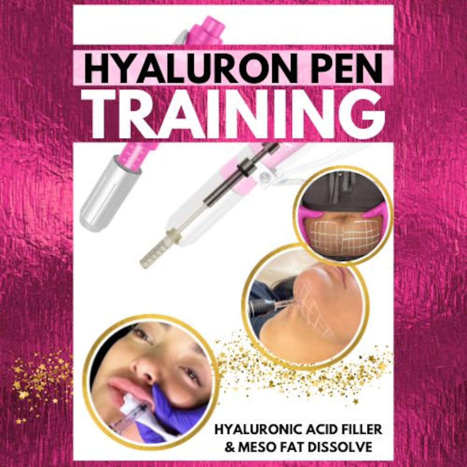 Hyaluron Pen Training Manual, Hyaluron Pen Course, Lip Fillers(no Edits ...