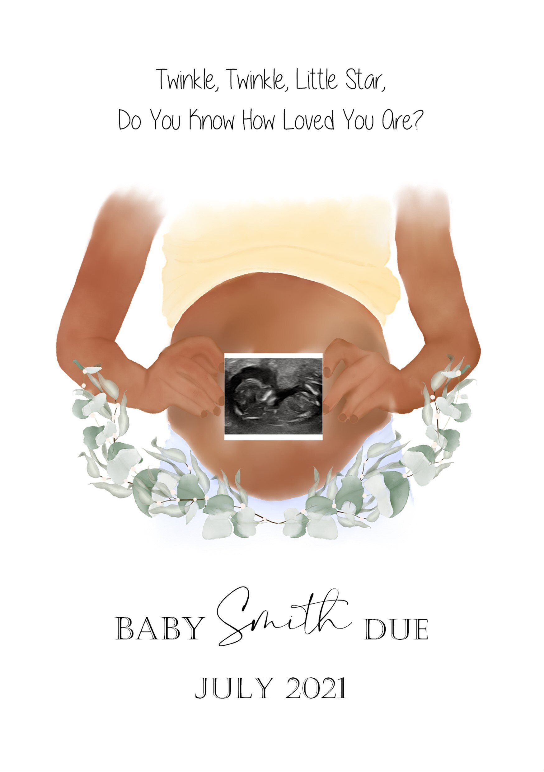 Personalised Baby Scan Baby Ultrasound Pregnancy Print - Etsy