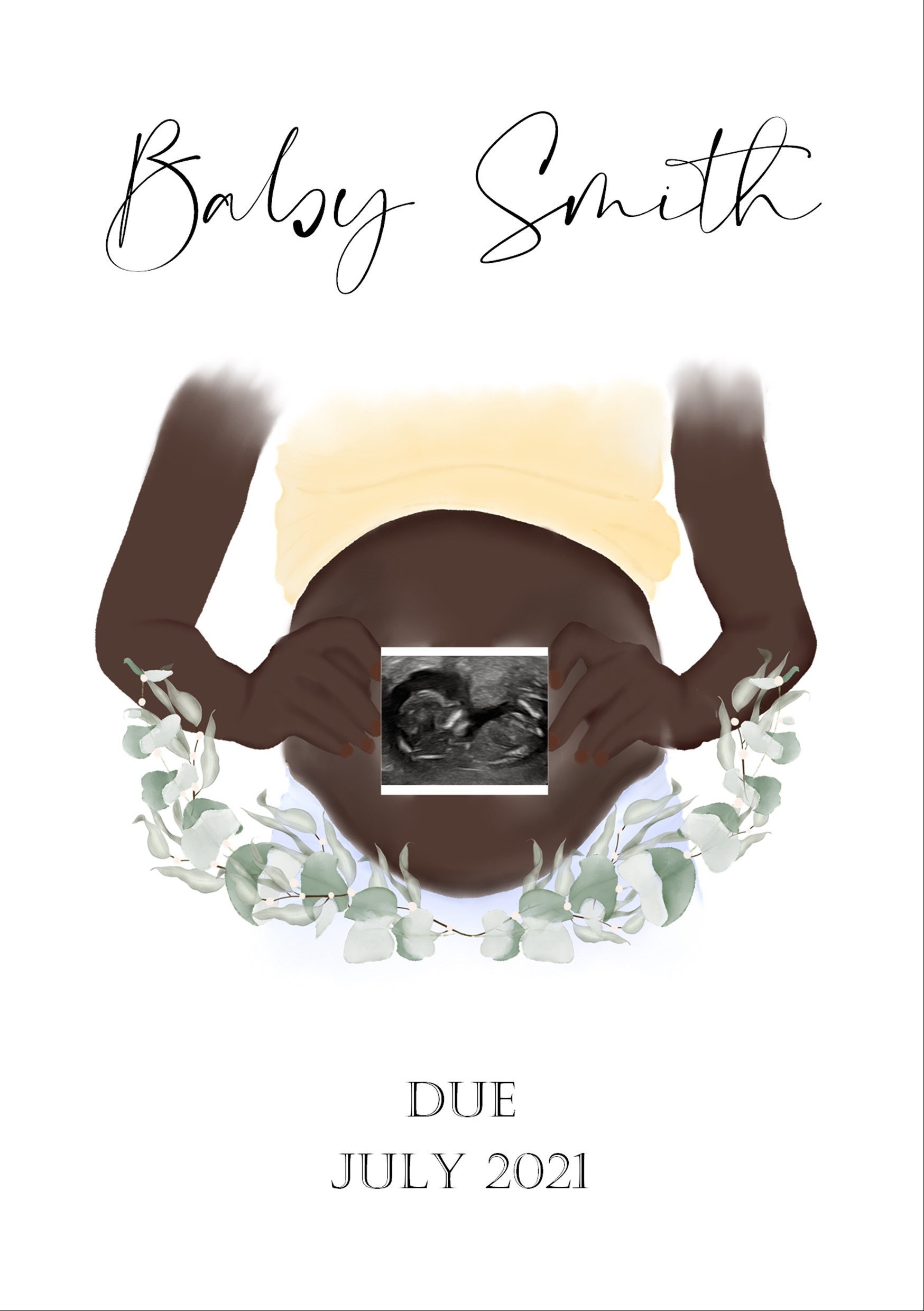 Personalised Baby Scan Baby Ultrasound Pregnancy Print - Etsy