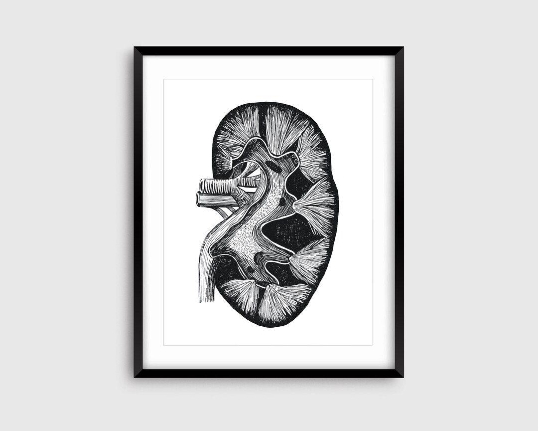 Kidney Pen Print Drawmyinsides Anatomy Art for Doctors - Etsy Australia