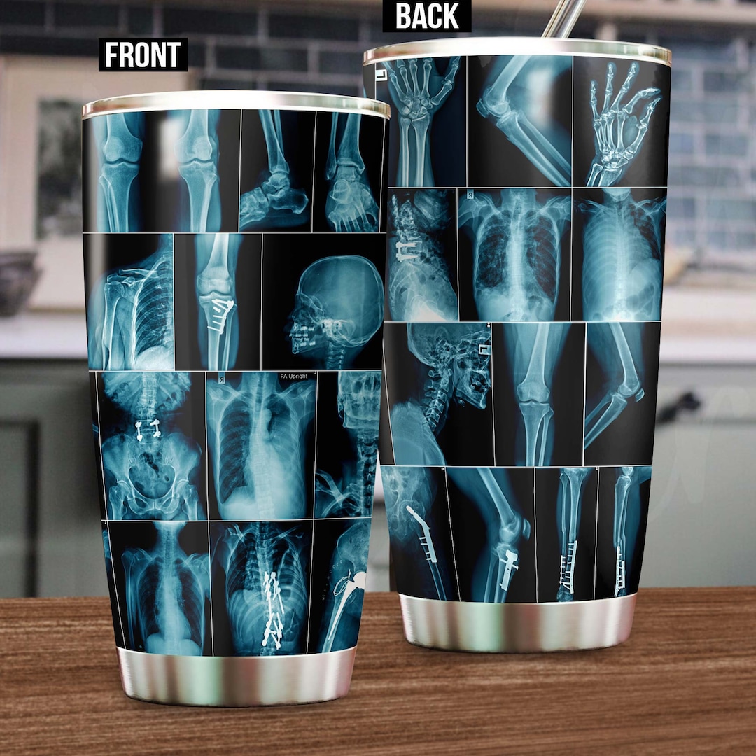 Radiologist 20 Oz Tumbler, Radiologist Gifts, Graduation Gifts ...
