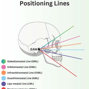 Radiography & Fluoroscopy Procedures Review - Etsy