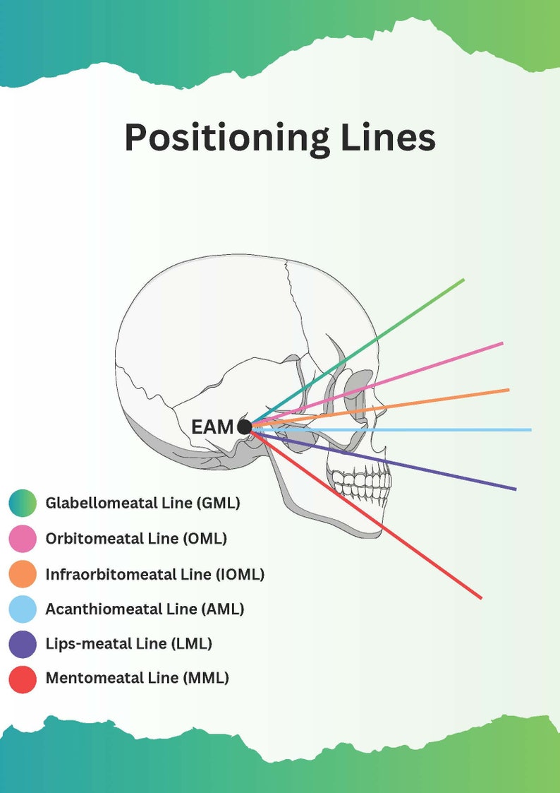 Radiography & Fluoroscopy Procedures Review - Etsy