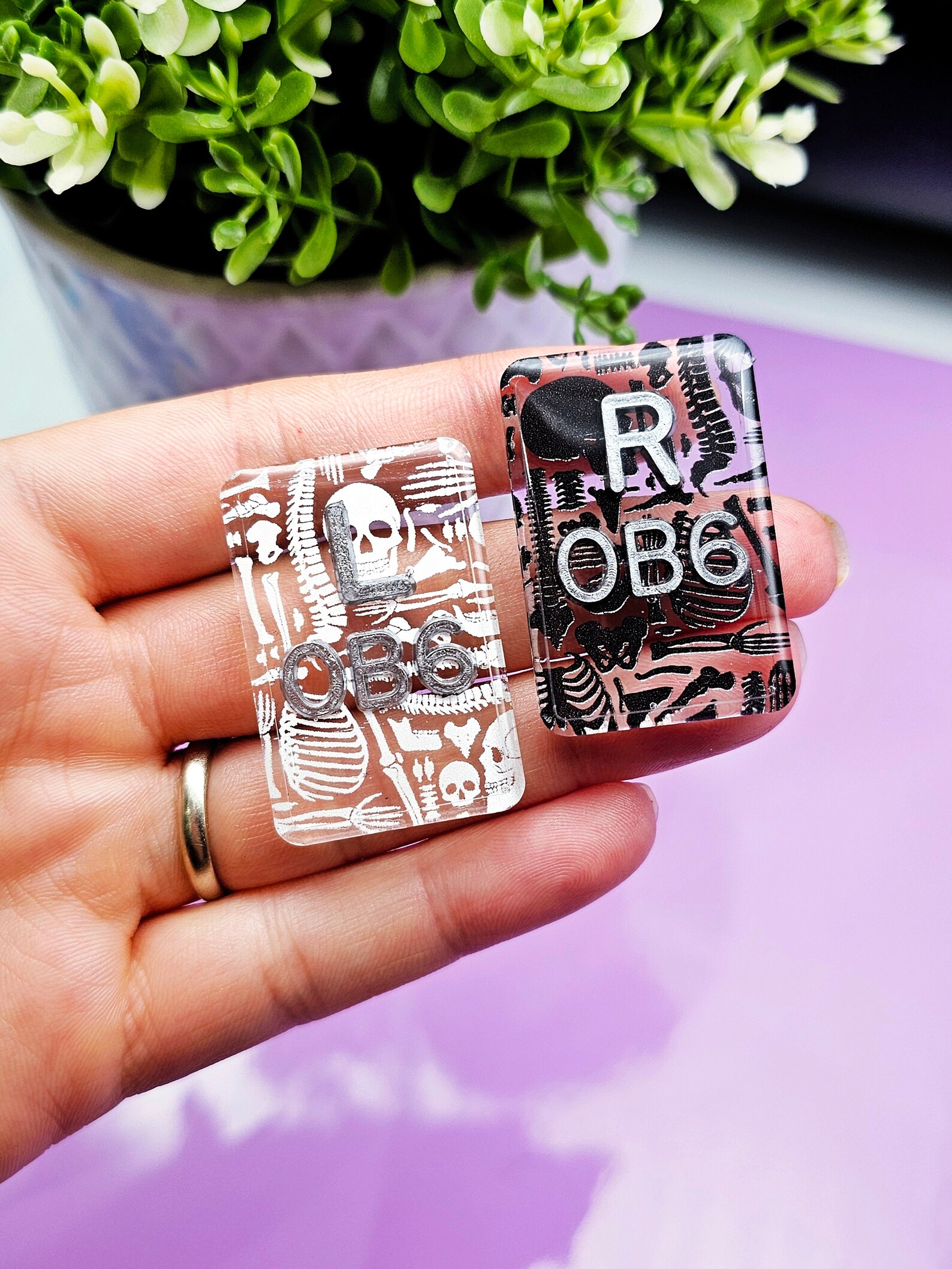 Anatomy Bones Xray Markers Anatomy X-ray Markers, Radiology Marker Set ...