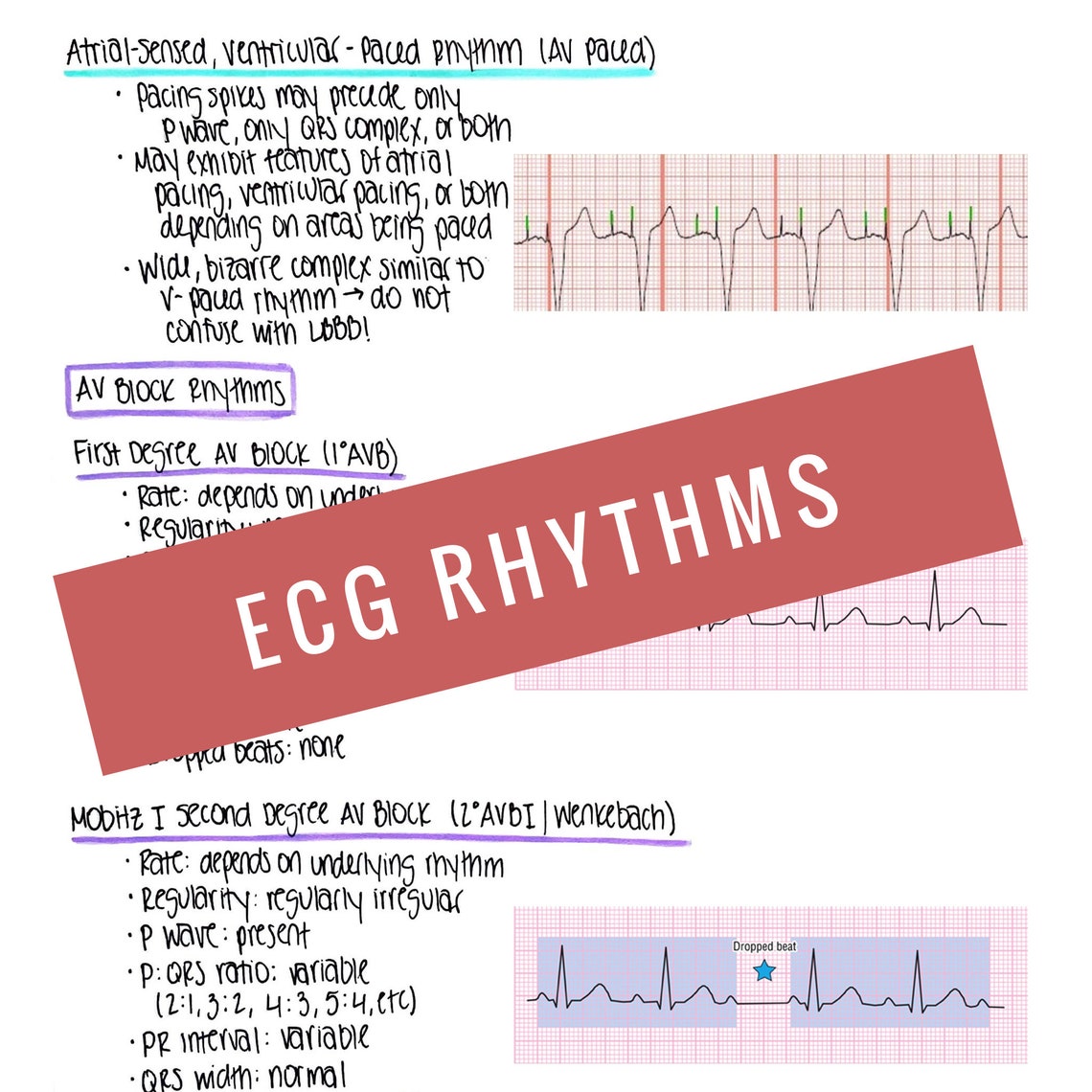 Complete List of ECG Rhythms Study Sheets, EKG Interpretation, Nursing ...