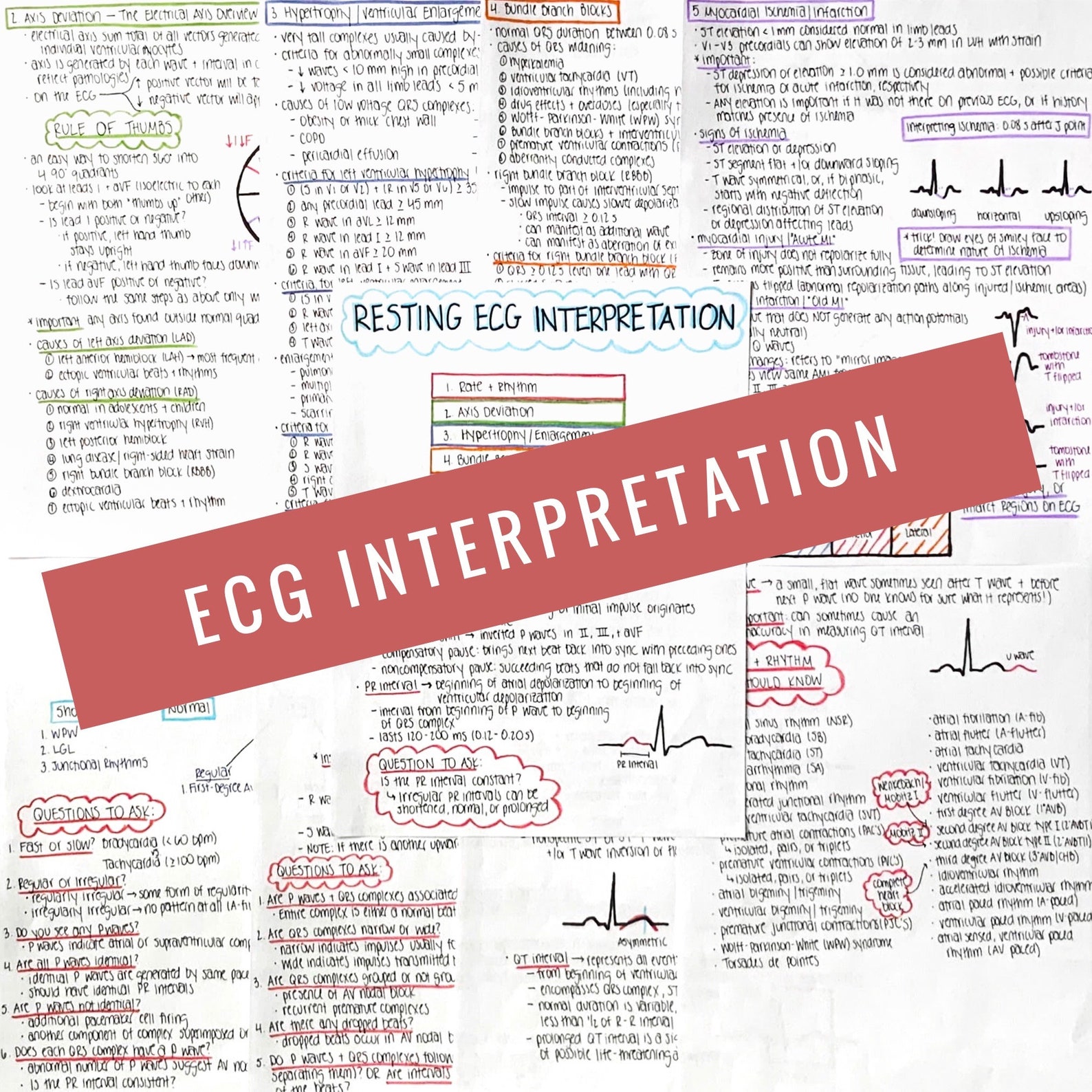 Resting ECG Interpretation Study Sheets, EKG Interpretation, Nursing ...