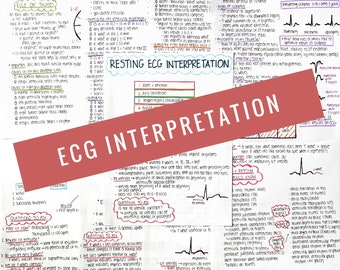 Complete List of ECG Rhythms Study Sheets, EKG Interpretation, Nursing ...