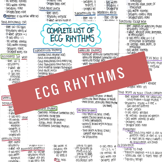 Complete List of ECG Rhythms Study Sheets EKG Interpretation - Etsy