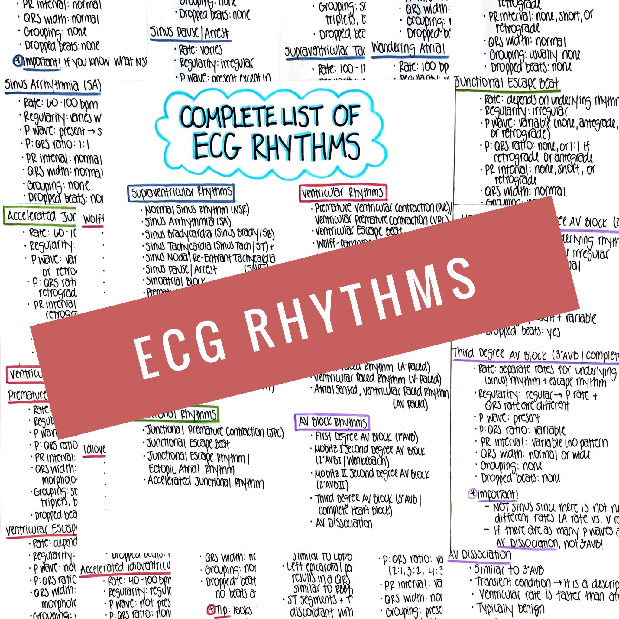 Complete List of ECG Rhythms Study Sheets, EKG Interpretation, Nursing ...