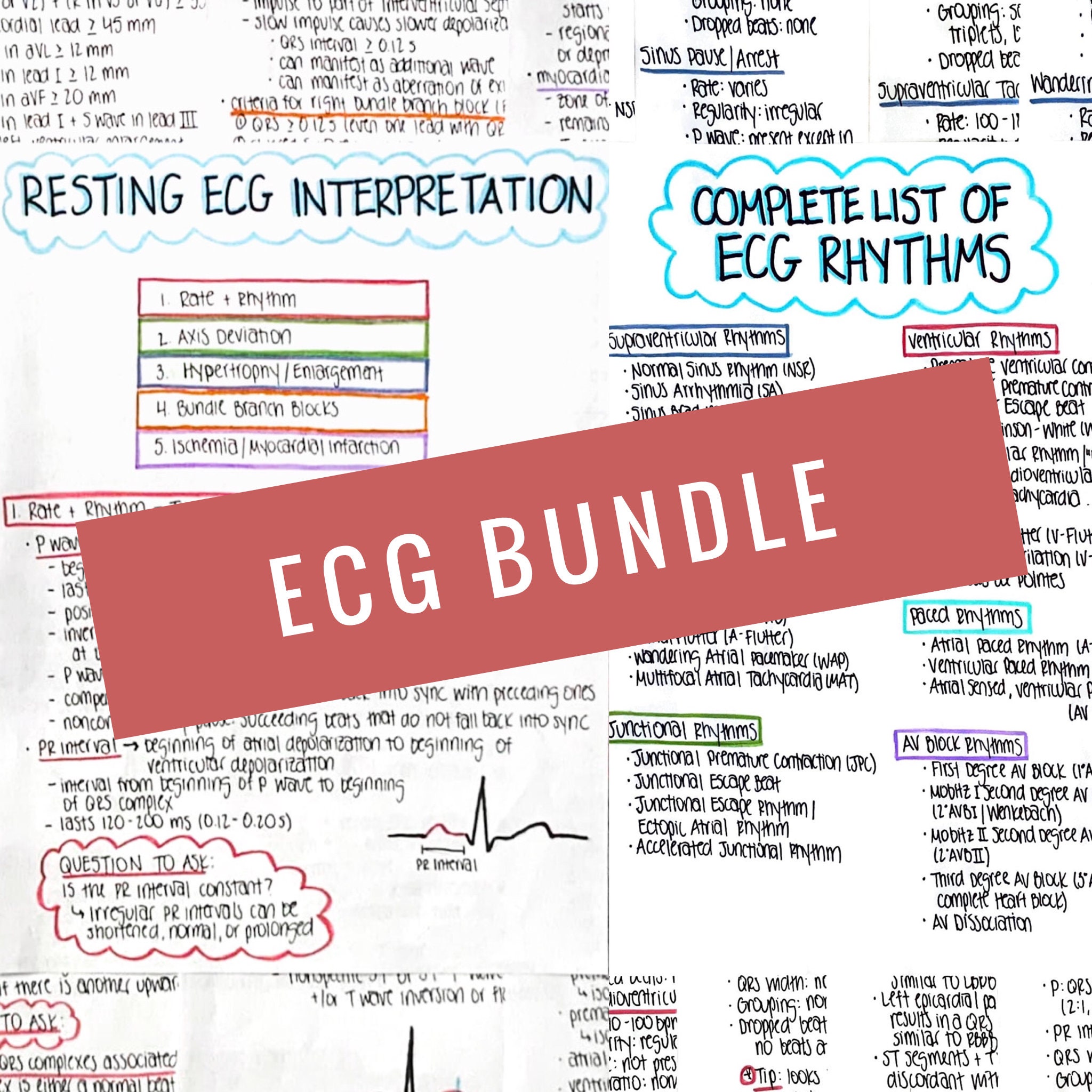 ECG Rhythms & Interpretation Bundle, EKG Interpretation, Nursing Notes ...