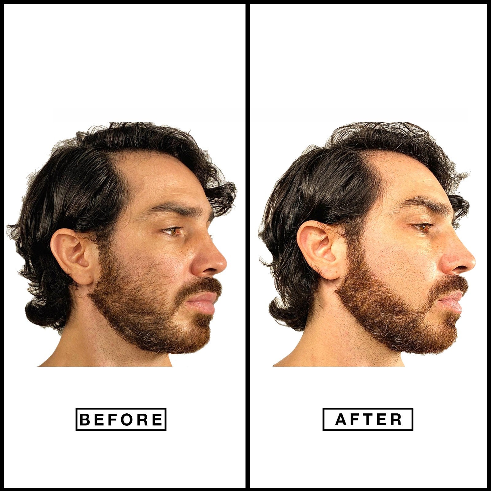 Herramienta de modelado de barba Perfecto para la línea de barba ...