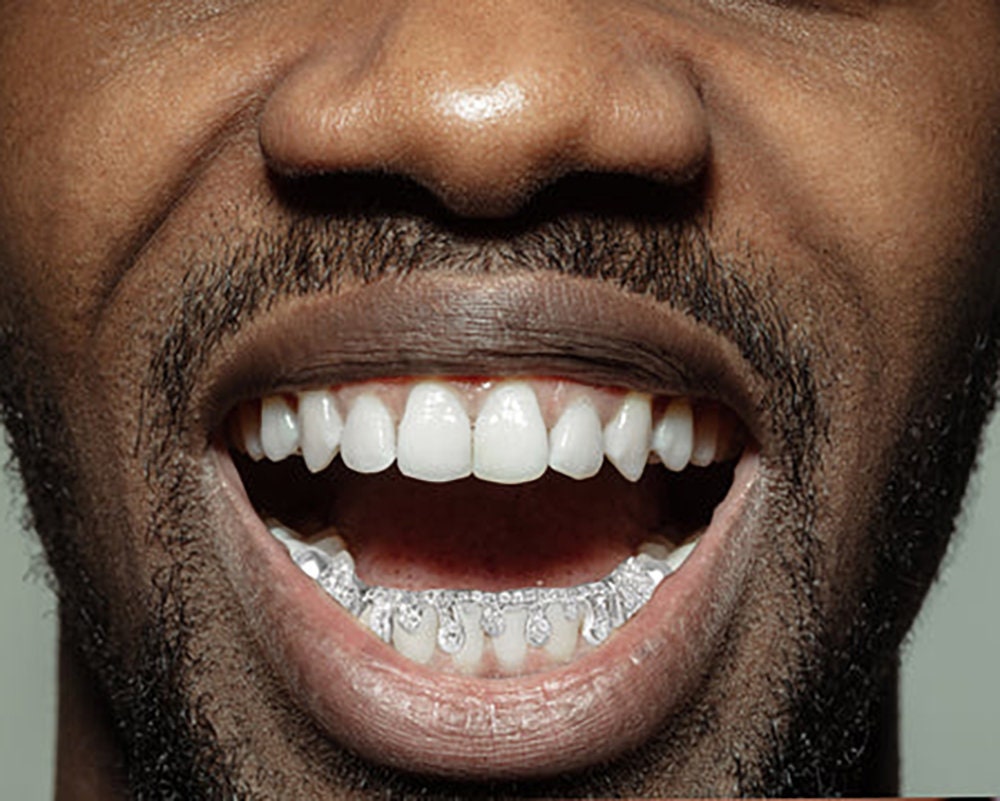 Diamond Drip Grillz 925 Solid Sterling Silver 10K 14K 18K Yellow White ...