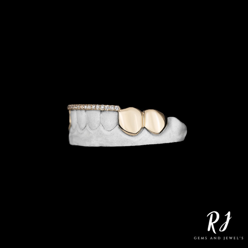 Custom Moissanite Diamond Grillz: Sterling Silver Bar Teeth, Rapper ...