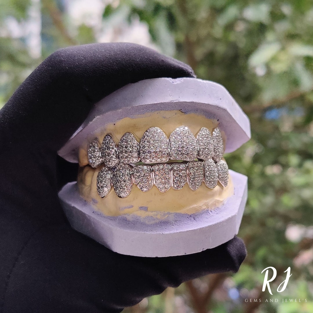 Custom VVS Moissanite Diamond Grillz: 14K Rose Gold Tooth Jewelry - Etsy