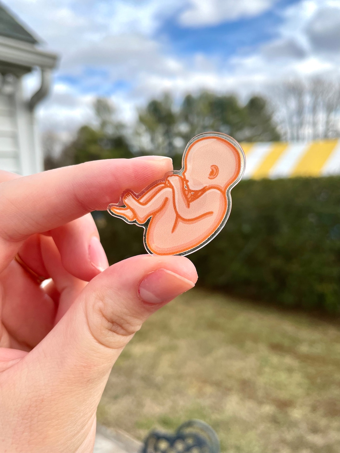 Pro Life Pin 1.5x1.3in Love Them Both Conservative Libertarian ...