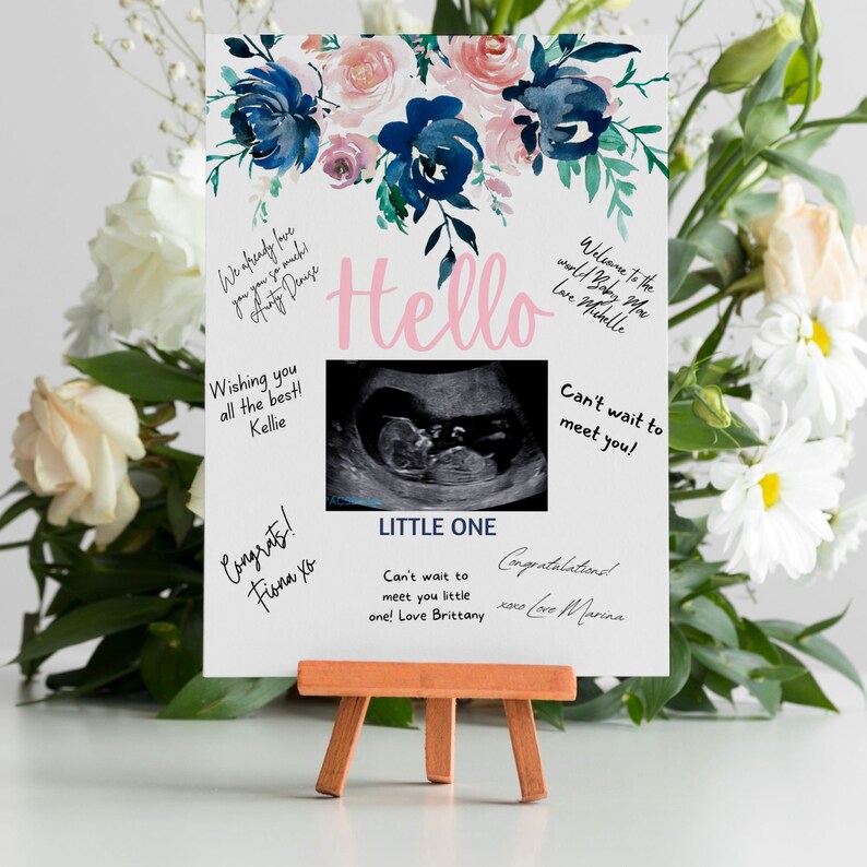 Baby Sonogram Photo Sign in Navy and Blush. Baby Ultrasound Printable ...