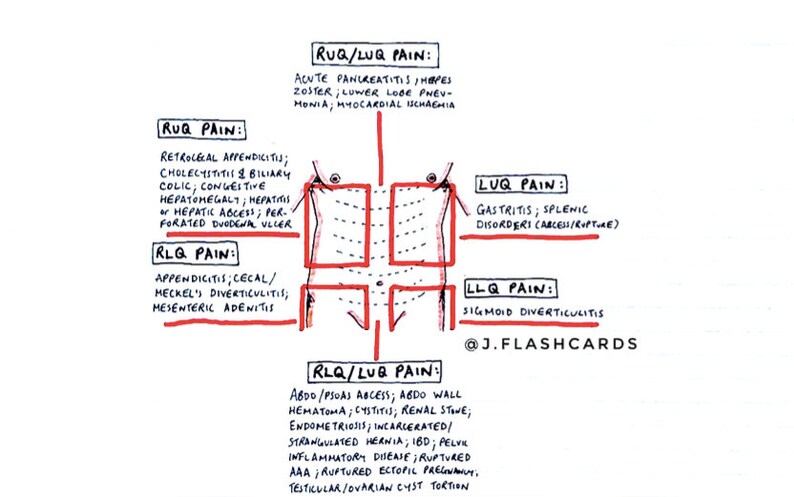 Gallbladder & Pancreatitis Flashcards (PDF) - Etsy