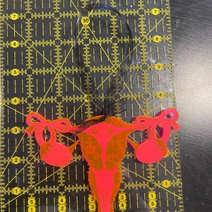 Happy Uterus Falopian Tubes Tied Surgery Anatomy Christmas Ornament - Etsy