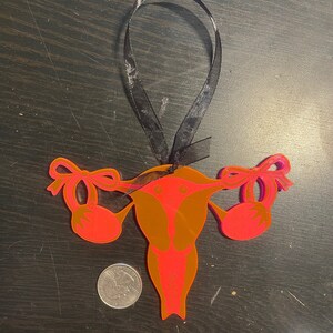 Happy Uterus Falopian Tubes Tied Surgery Anatomy Christmas Ornament - Etsy