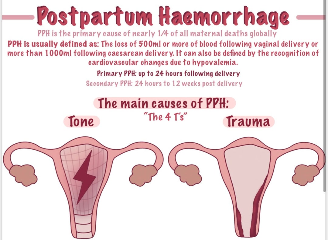 PPH -downloadable PDF File - Etsy