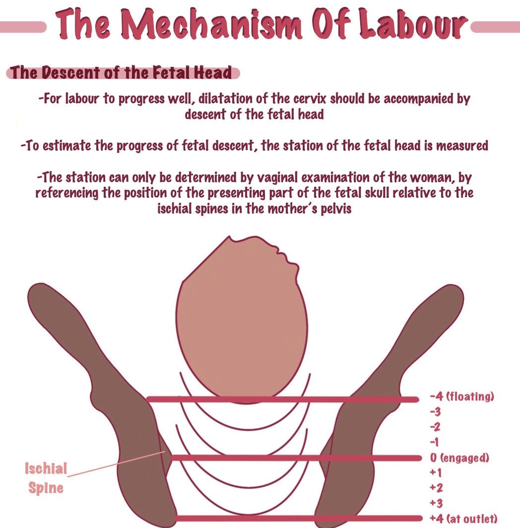 The Mechanism of Labour -downloadable PDF Notes - Etsy Australia