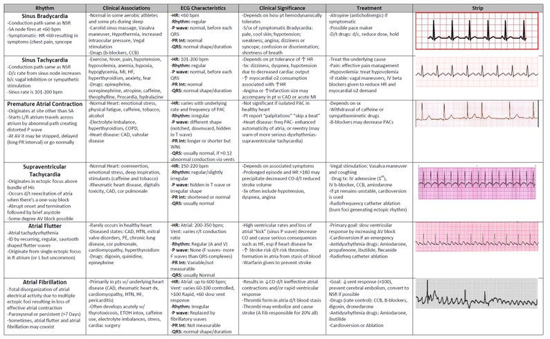 Cardiac Dysrhythmia Chart Med-surg - Etsy