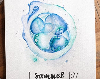 Custom Embryo Original Watercolor Painting, IVF Art, Embryo Art, IVF ...