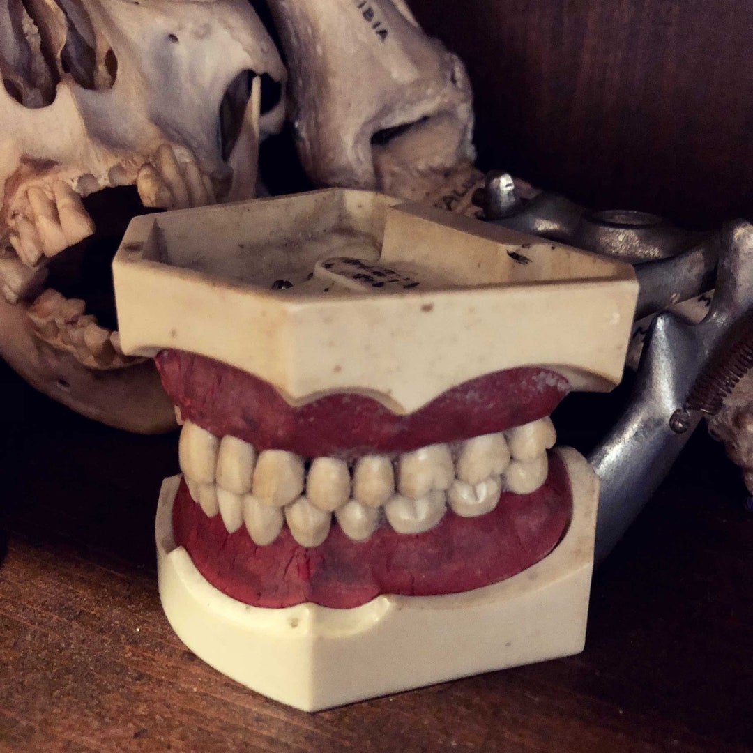 Vintage Articulated Dental Model - Etsy