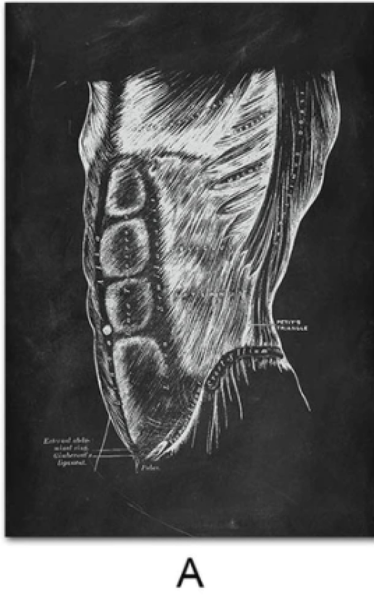 Anatomy Blackboard Canvas Prints Wall Art Medical Poster Prints Human ...