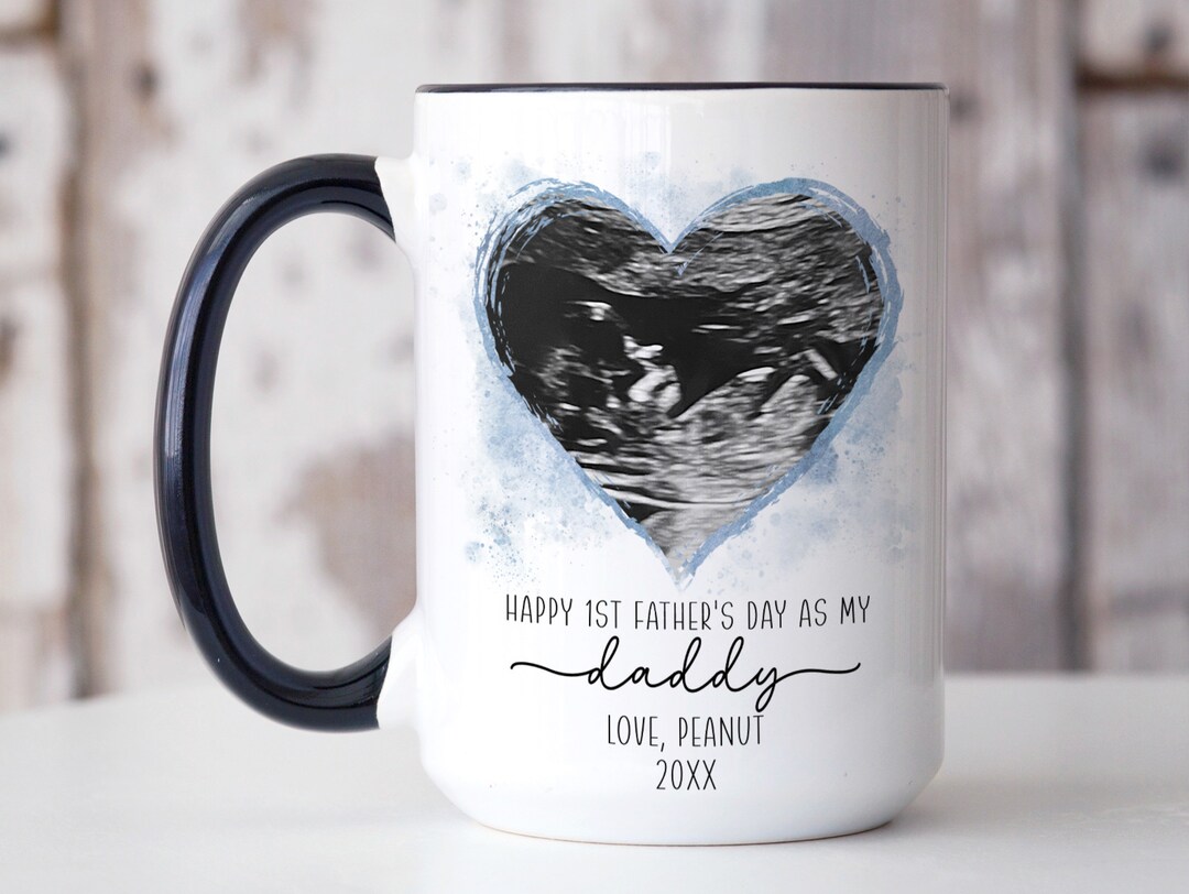 Fathers Day Gift for First Time Dad Gift From Wife, Ultrasound Mug ...