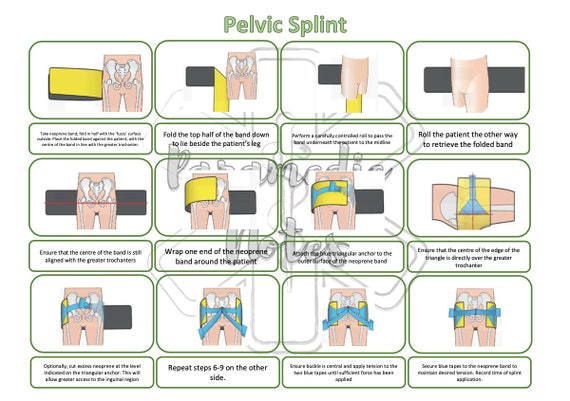 Pelvic Splint/binder - Etsy