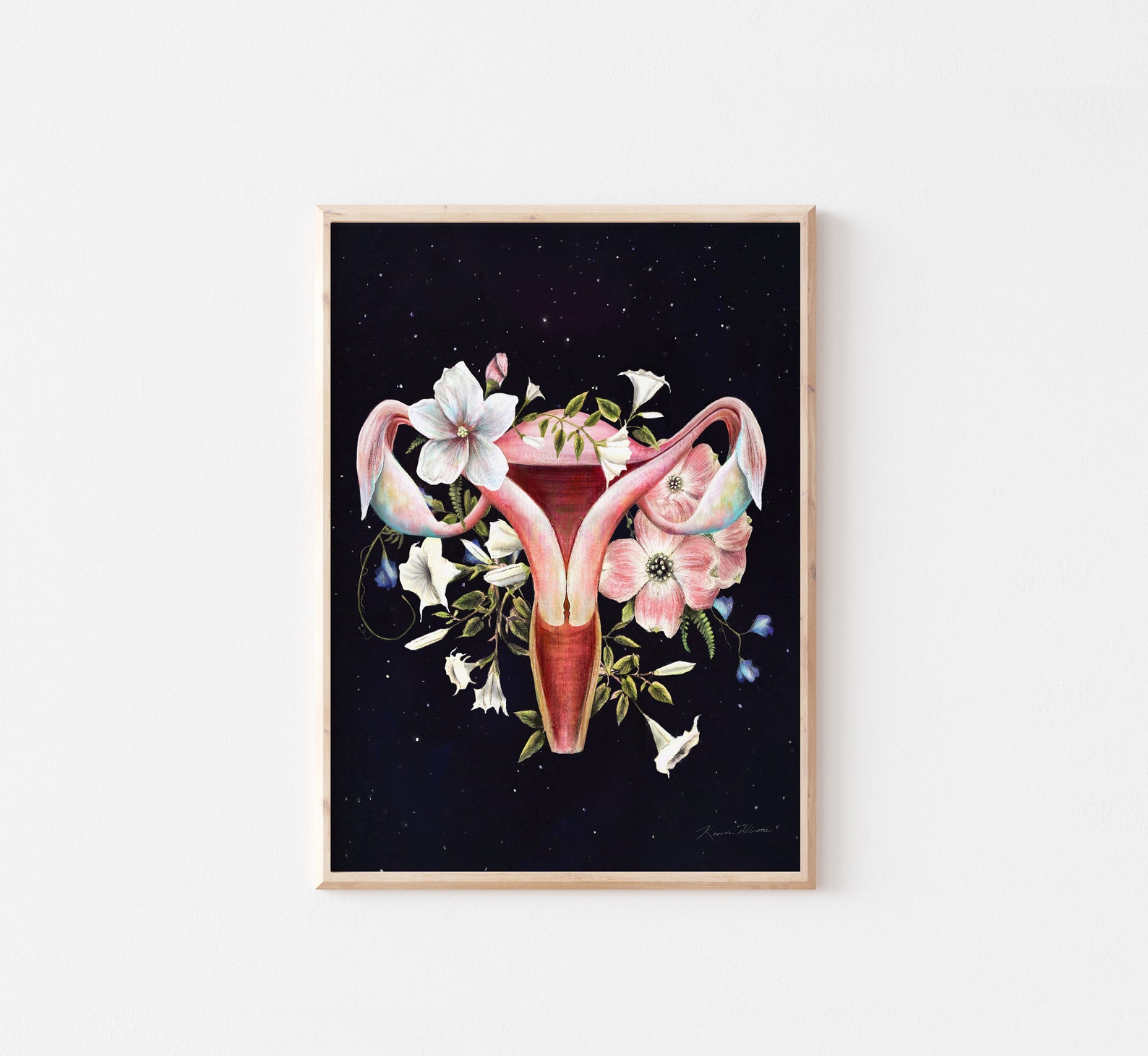 Floral Uterus, Uterus Anatomy, Art Print for Women's Healthcare ...