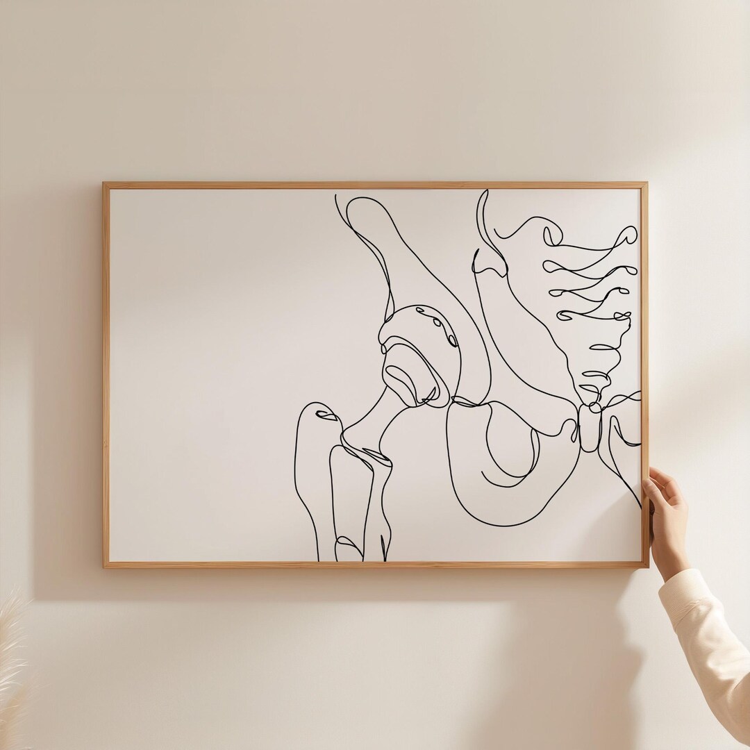 Minimalist Hip Replacement Line Art, Digital Download, Hip Arthroplasty ...