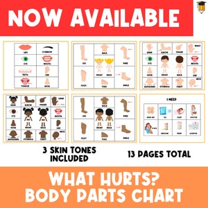 What Hurts Child Pain Chart Visual Aid Non Verbal Toddler Chart ...