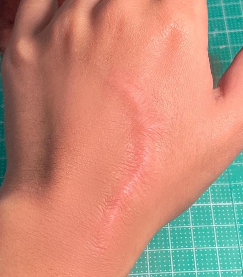 Pack of 10 SCARS Prosthetics. to Be Applied on a Flat Surface ...