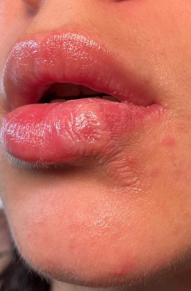 Pack of 10 SCARS Prosthetics. to Be Applied on a Flat Surface ...