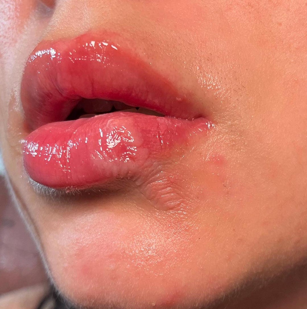 Pack of 10 SCARS Prosthetics. to Be Applied on a Flat Surface ...