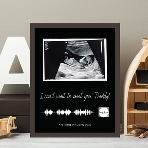 Baby's First Heartbeat-scannable QR Code With Your Heartbeat Recording ...