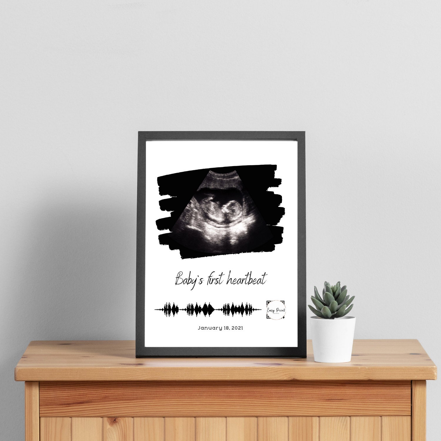 Custom Baby's First Heartbeat Printable-pregnancy - Etsy