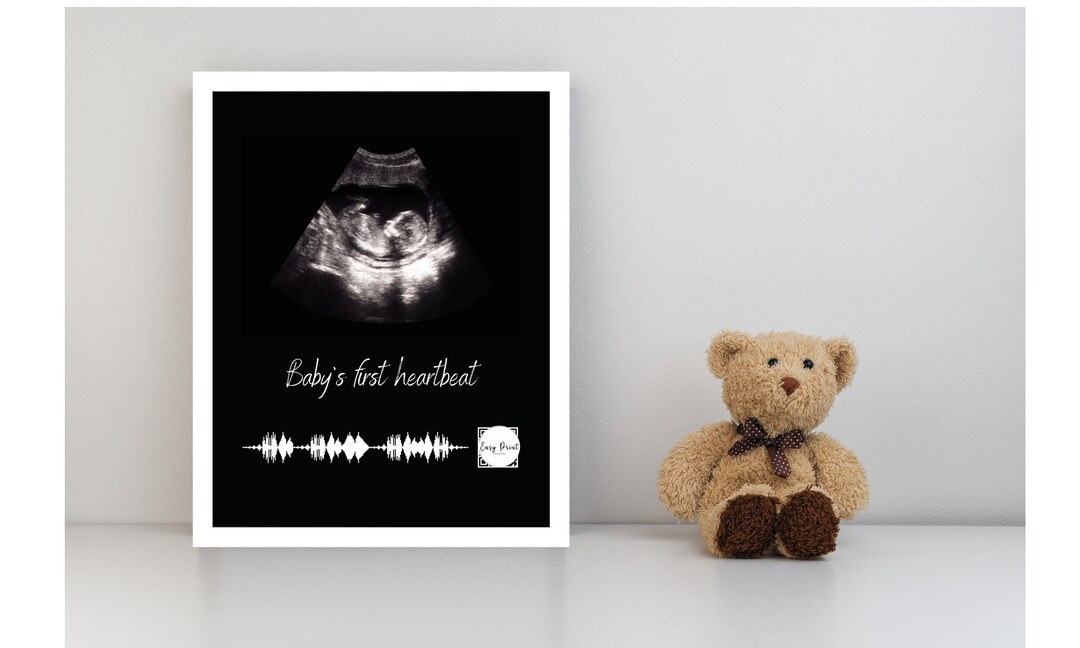 Baby's First Heartbeat-scannable QR Code With Your Heartbeat Recording ...